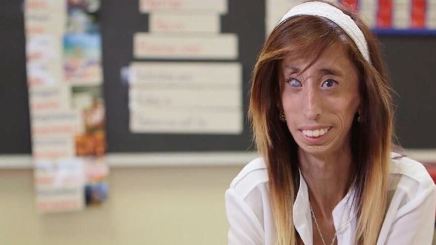 Lizzie Velasquez Profile, Age, Height, Weight, Family, Biography